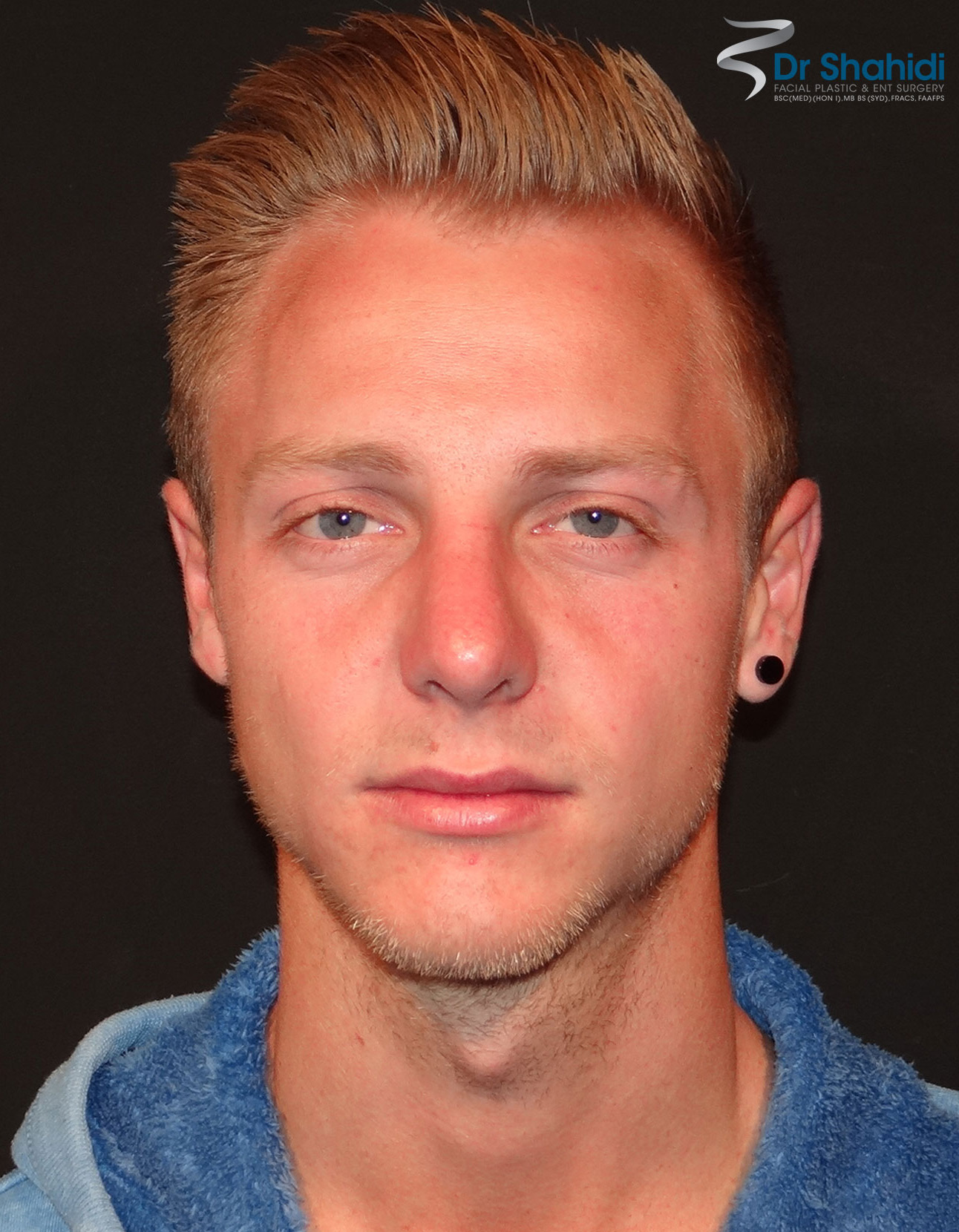 Adam.BA.Front-b - Dr Shahidi