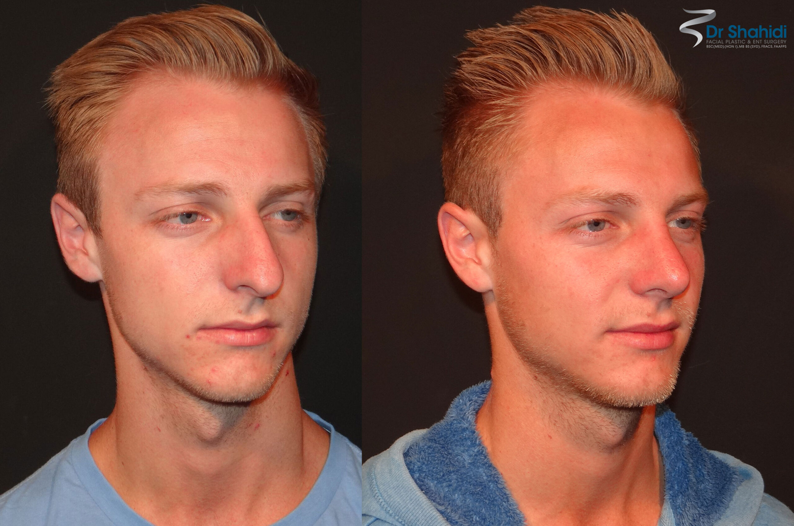 Adam.BA.FrontSide - Dr Shahidi