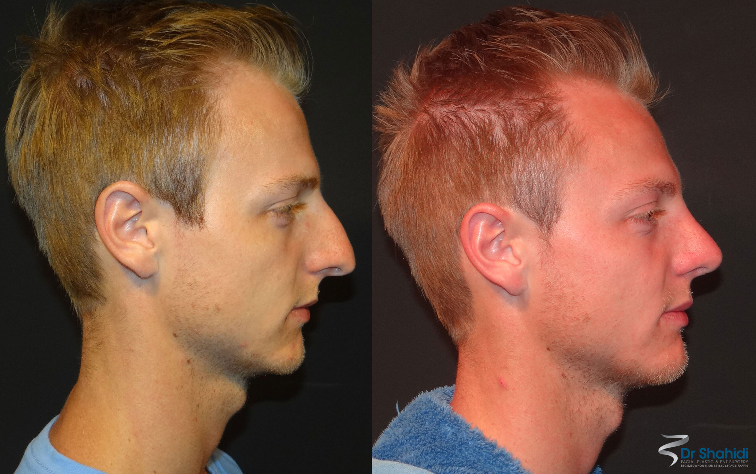 Adam.BA.Side - Dr Shahidi