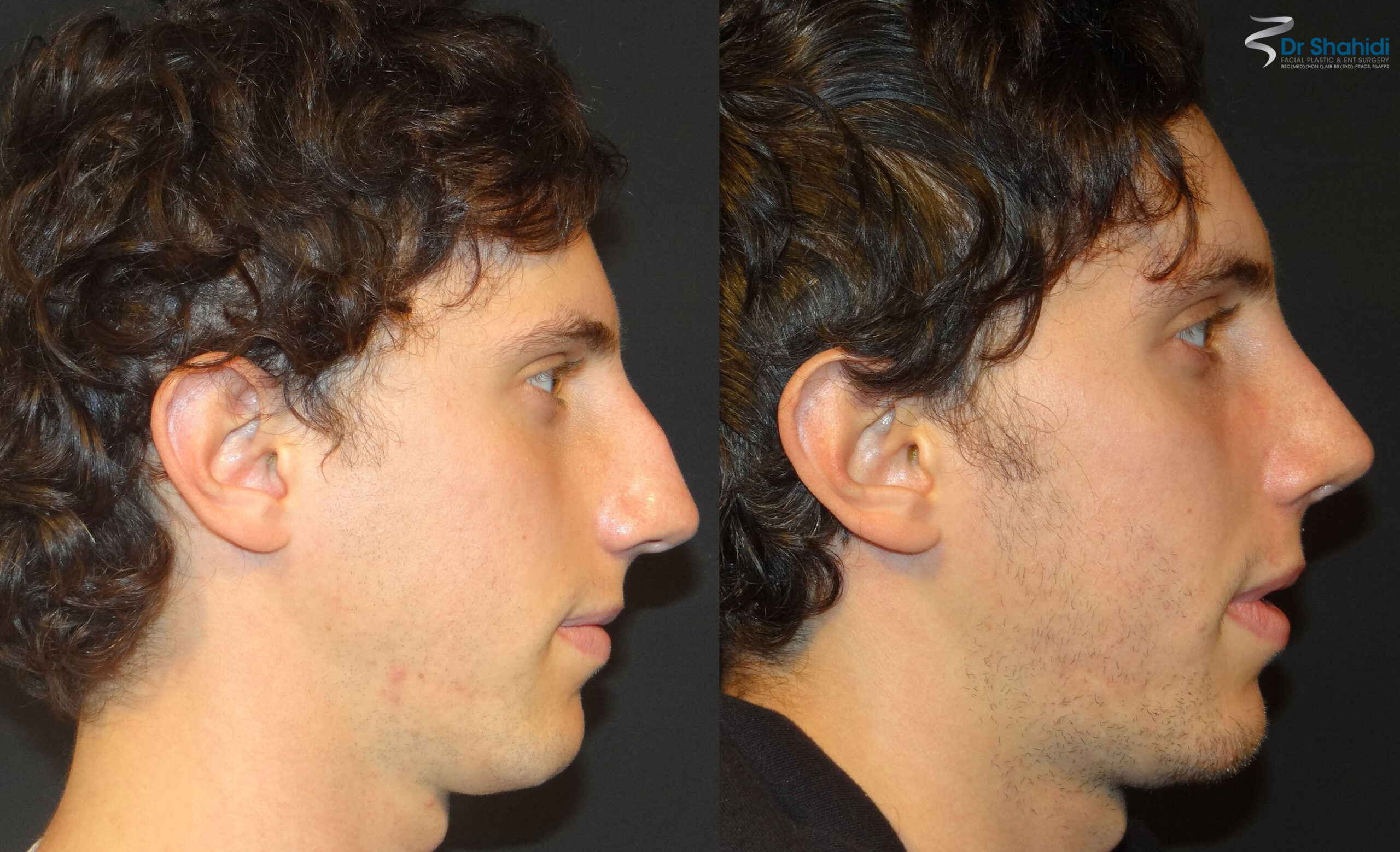 Andrew.T.BA.Side - Dr Shahidi