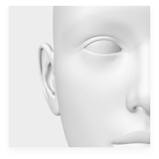 Otoplasty (Ear Pinning) Surgery - Dr Shahidi