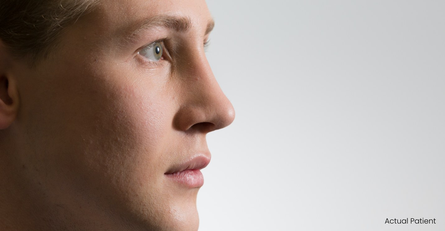 Nose Surgeon in Sydney | Nose Surgery | Dr Shahidi